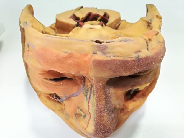 Welcome to Anatomy MUSEUM – #Anatomy SC Mahidol #Anatomy MUSC ภาควิชา ...