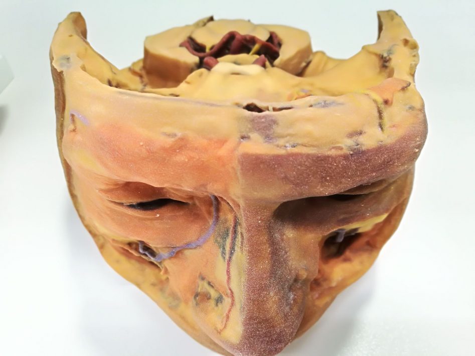 Welcome to Anatomy MUSEUM – #Anatomy SC Mahidol #Anatomy MUSC ภาควิชา ...