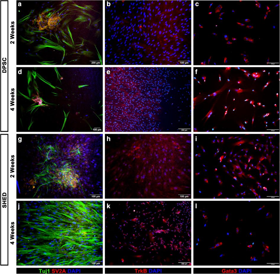 Neuronal differentiation of dental pulp stem cells from human permanent ...