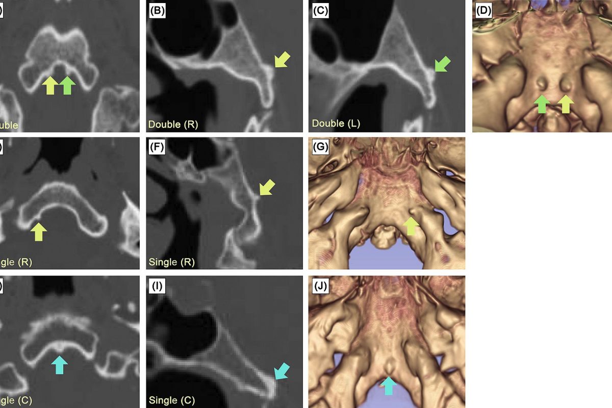 #Anatomy SC Mahidol #Anatomy MUSC ภาควิชากายวิภาคศาสตร์ คณะวิทยาศาสตร์ ...