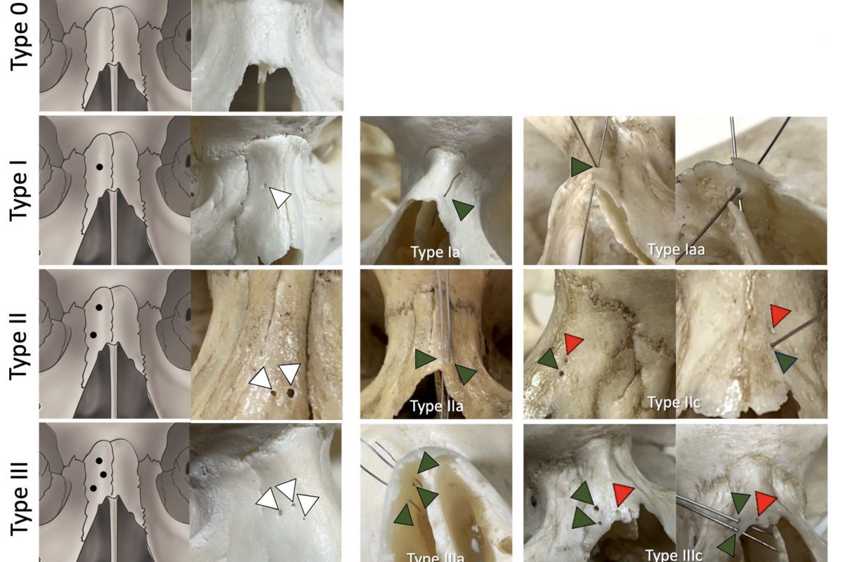 #Anatomy SC Mahidol #Anatomy MUSC ภาควิชากายวิภาคศาสตร์ คณะวิทยาศาสตร์ ...